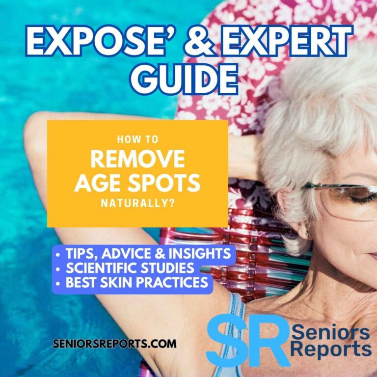 Top How to Remove Age Spots Naturally Seniors Expert Tips